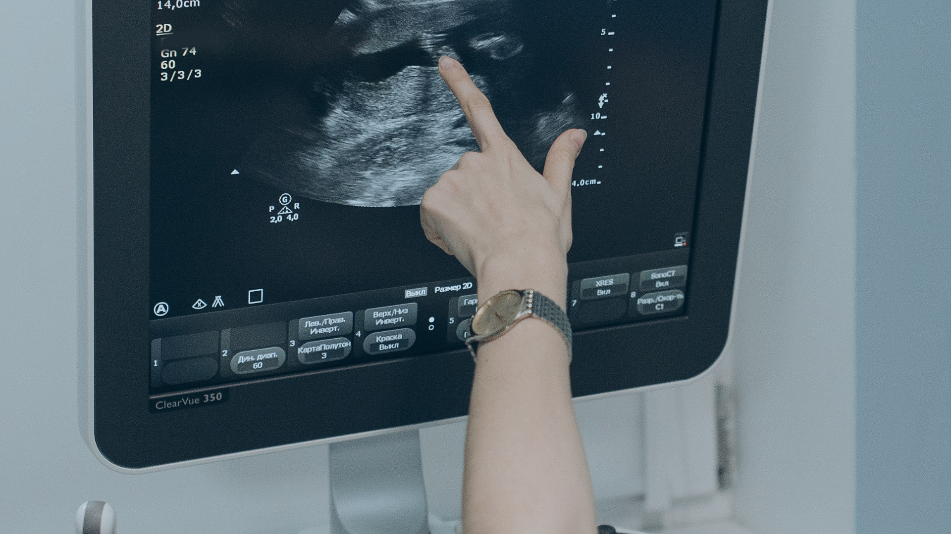Application & Advancement Of Ultrasound Technology – SONO Supplies